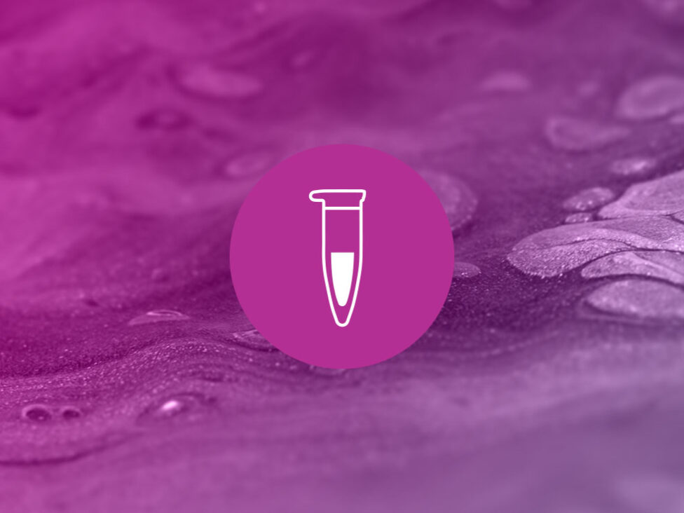 Isothermal Amplification | PCR Biosystems