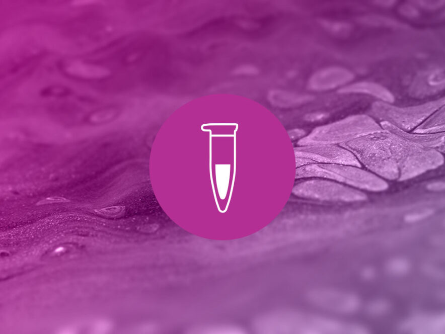 Isothermal Amplification | PCR Biosystems