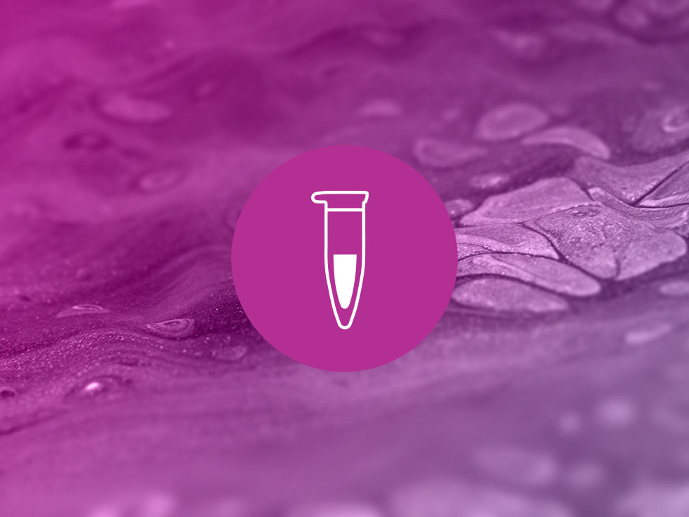 Isothermal Amplification | PCR Biosystems